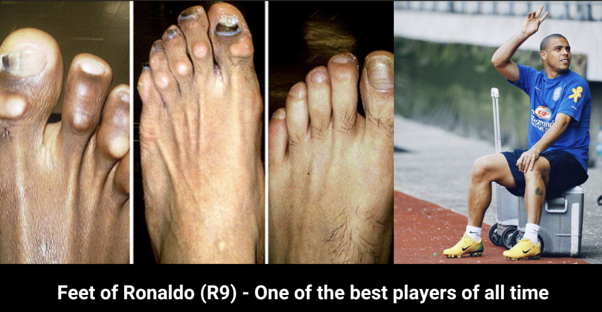 A Full Guide on How to Care of your Soccer Player Feet